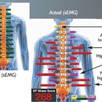 emg – DARBY CHIROPRACTIC of New Iberia